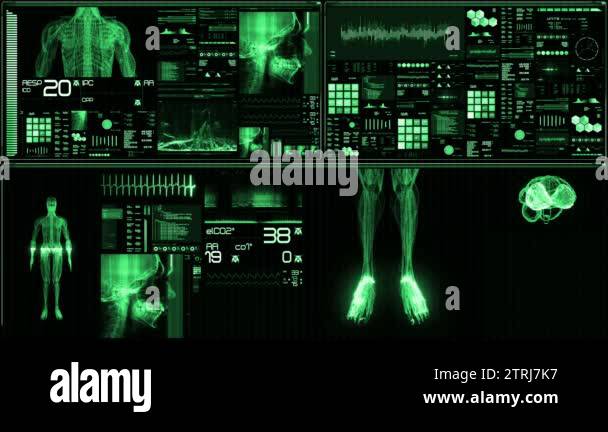 Green futuristic patient monitor screen in perspective / Medical screen ...