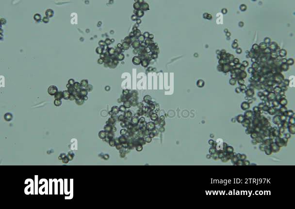 Trypanosoma cruzi, bright field microscope, kissing bug feces Stock ...