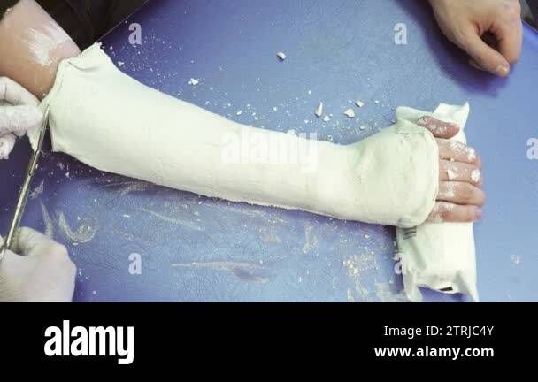 Gypsum arm Stock Videos & Footage - HD and 4K Video Clips - Alamy