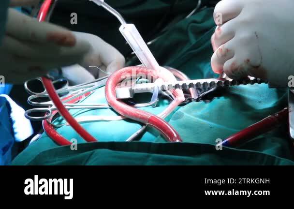 Heart cardiac Stock Videos & Footage - HD and 4K Video Clips - Alamy