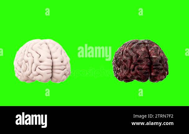 Autopsy brain Stock Videos & Footage - HD and 4K Video Clips - Alamy