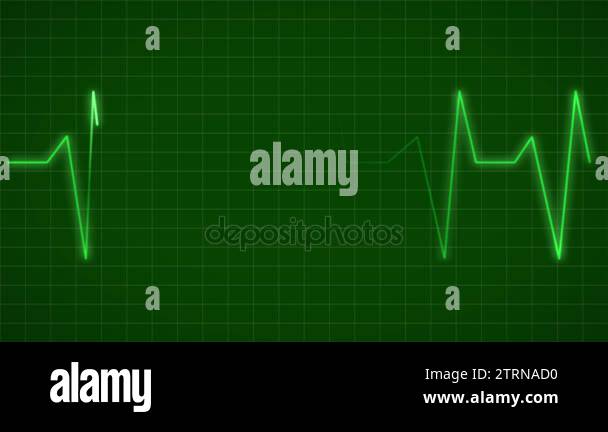 ECG Electrocardiogram Display Heart Rate Beat Pulse Looped animated ...