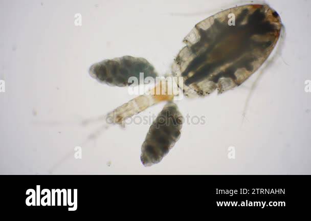 Cyclops freshwater eggs Stock Videos & Footage - HD and 4K Video Clips ...