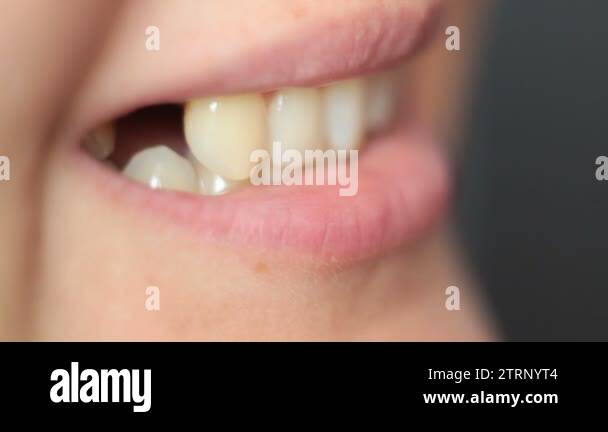 checking the wound after tooth extraction, the lack of premolar;two ...