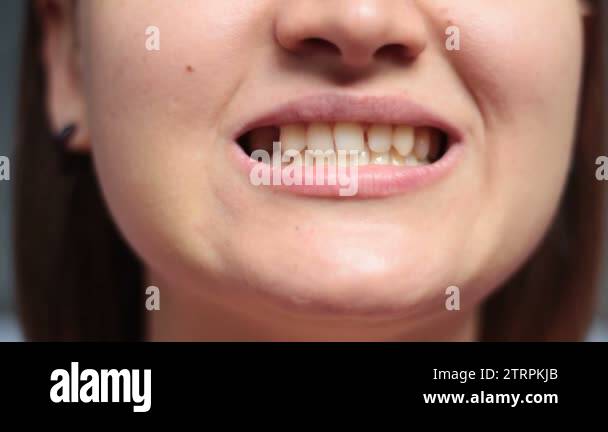 girl stretching her mouth and shows the wound after tooth extraction ...