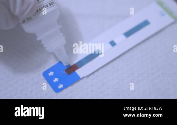 Reagent strip Stock Videos & Footage - HD and 4K Video Clips - Alamy