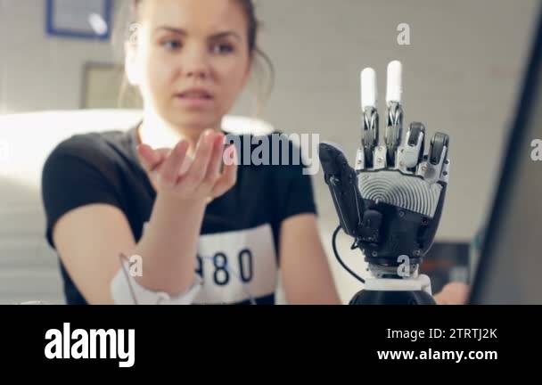 Female controls electronic prosthetic arm using bionics technology ...