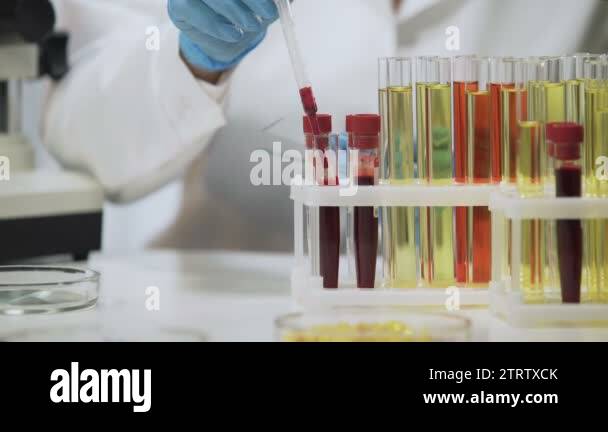 Clinical test Stock Videos & Footage - HD and 4K Video Clips - Alamy