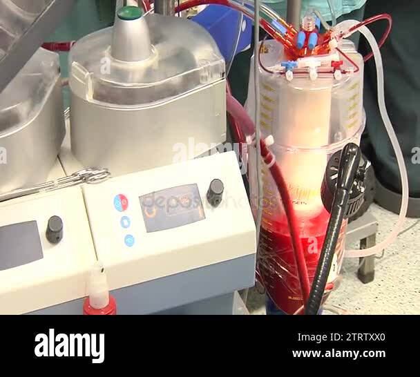 Working Heart-Lung Bypass Machine. Surgery in modern operating room ...
