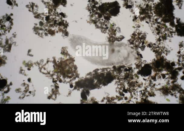 Paramecium ciliates under the microscope in 4k Stock Video Footage - Alamy