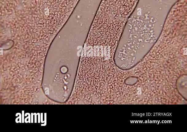 Blood Cell Channel 100x. Blood Platelets seen forming a small pathway ...