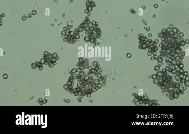 Trypanosoma cruzi in kissing bug feces, bright field microscope view ...