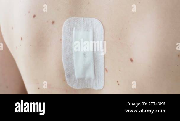 Scalpel sutures Stock Videos & Footage - HD and 4K Video Clips - Alamy
