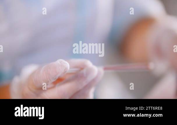 Medical clinic. A blood test. Dripping the blood on the glass and ...