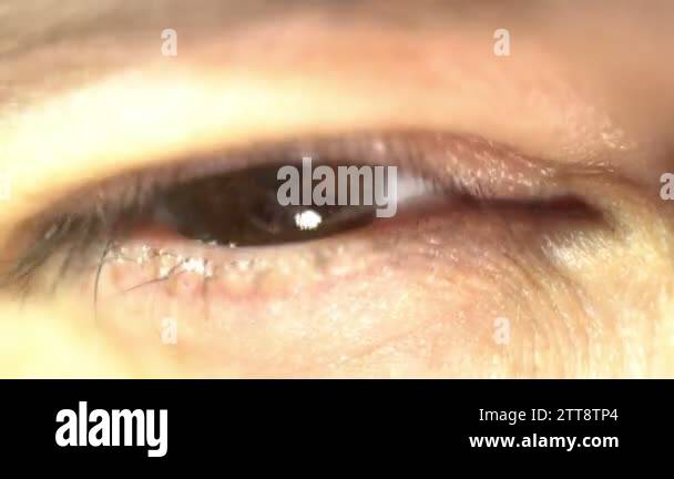 Bad for eye health Stock Videos & Footage - HD and 4K Video Clips - Alamy