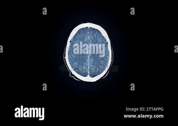 Human brain scan mri health Stock Videos & Footage - HD and 4K Video ...