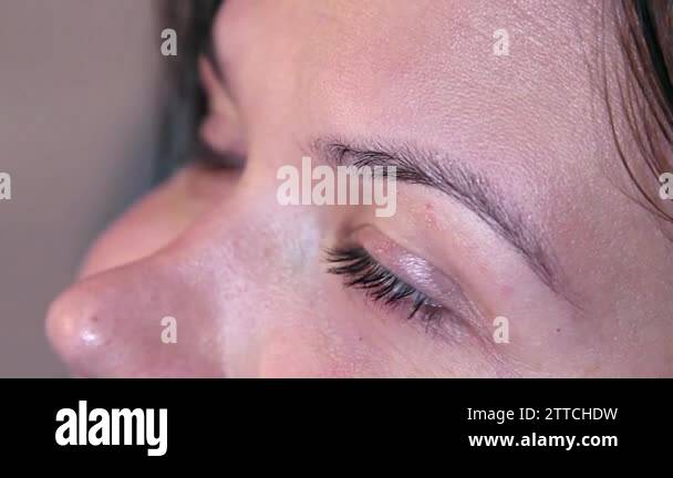The girl uses eye ointment, eye ointment, correct use of ophthalmic ...