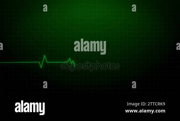 EKG Heartbeat on Monitor Recording of Pulse - Green Healthcare Animated ...