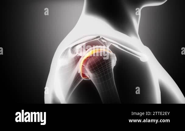Shoulder cartilage anatomy Stock Video Footage - Alamy