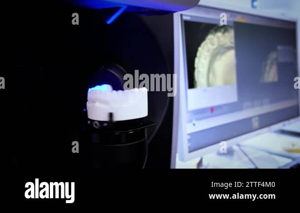 Dental prosthetic restoration. Denturist is making 3D model for ...