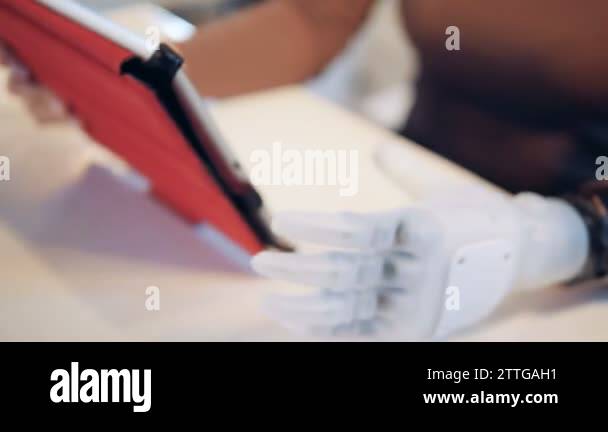 Artificial arm use Stock Videos & Footage - HD and 4K Video Clips - Alamy