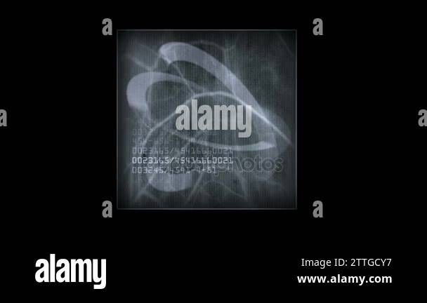 4k Human finger bone scan,tech medical X-ray data,medical research body ...