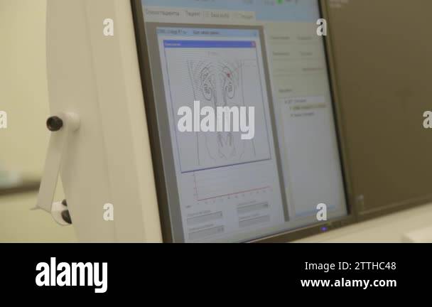 Operating screen Stock Videos & Footage - HD and 4K Video Clips - Alamy