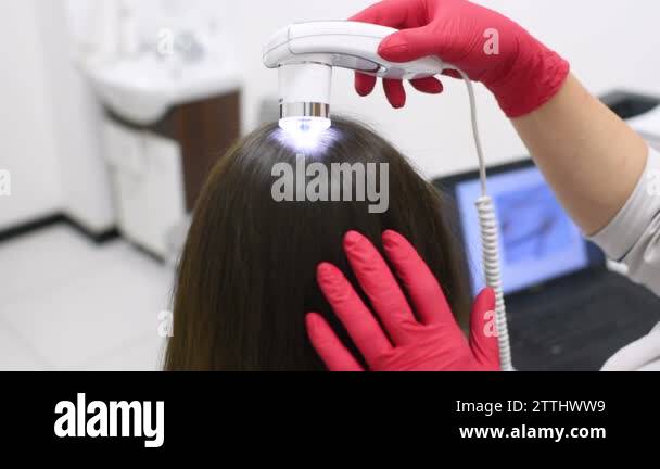 doctor dermatologist diagnoses the structure of the hair of a young ...