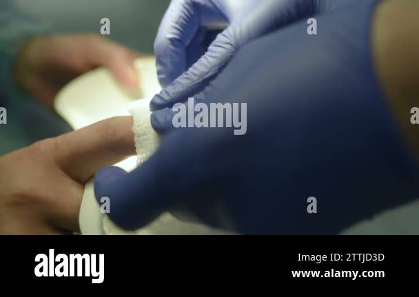 Hydrogen peroxide wound Stock Videos & Footage - HD and 4K Video Clips ...