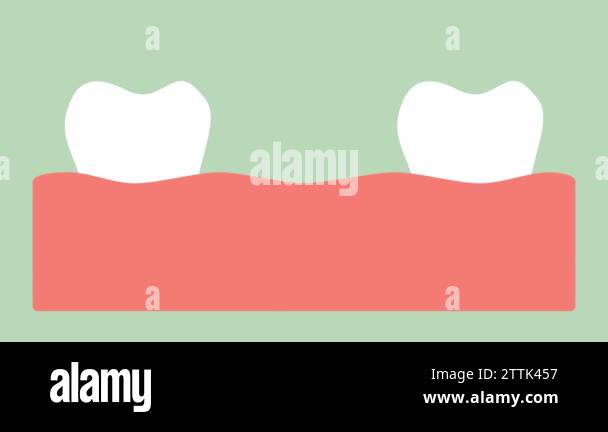 first tooth or baby teeth - dental cartoon vector flat style render 2d ...
