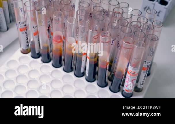 Empty sample bottles Stock Videos & Footage - HD and 4K Video Clips - Alamy