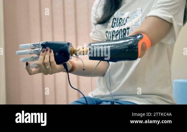 Robotic limb, prosthesis. Girl use bionic 3d printed arm for the first ...