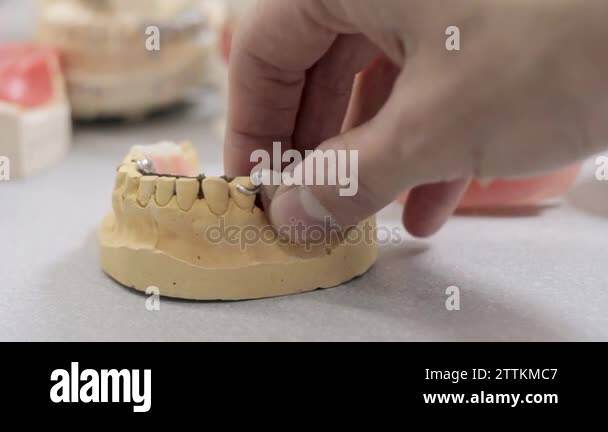 To remove the crown Stock Videos & Footage - HD and 4K Video Clips - Alamy