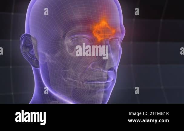 Sinus pressure pain treatment. 3d animated X-ray human body Stock Video ...