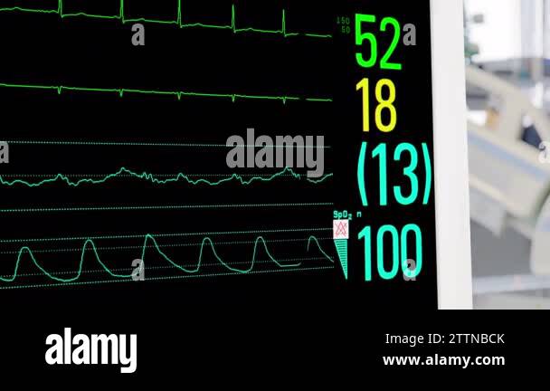 Icu sign Stock Videos & Footage - HD and 4K Video Clips - Alamy
