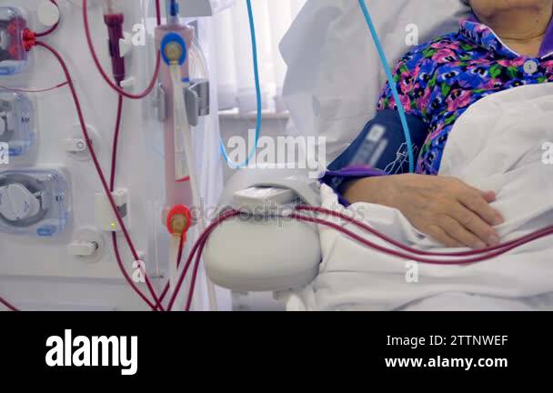 Dialysis patient connected dialysis machine Stock Videos & Footage - HD ...