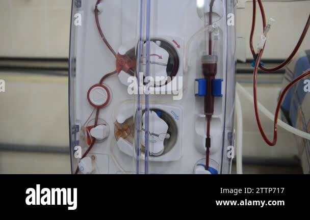 Dialysis tubing Stock Videos & Footage - HD and 4K Video Clips - Alamy