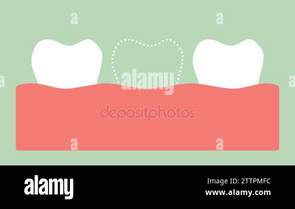 missing tooth, space in mouth - dental cartoon vector flat style render ...