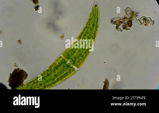Closterium algae Stock Videos & Footage - HD and 4K Video Clips - Alamy