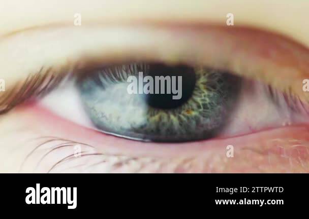 Macro View of Pupil Constriction Process in Human Eye. Constriction of the Iris with Bright ...