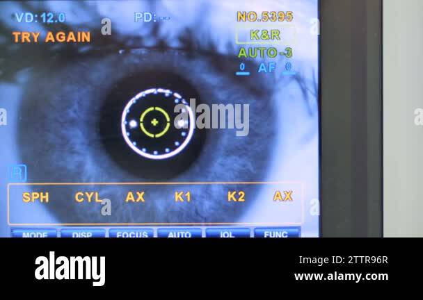 A modern autorefractometers screen showing as blinking human eyes get ...