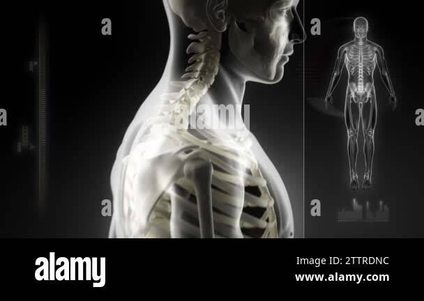 Spinal joints Stock Videos & Footage - HD and 4K Video Clips - Alamy