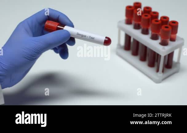 Dengue test, doctor showing blood sample in tube, lab research, health ...