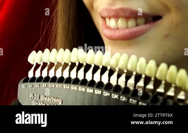 Teeth whitening chart Stock Videos & Footage - HD and 4K Video Clips ...