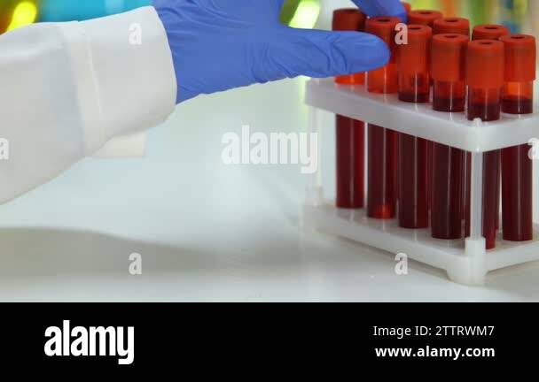 Biochemical test Stock Videos & Footage - HD and 4K Video Clips - Alamy
