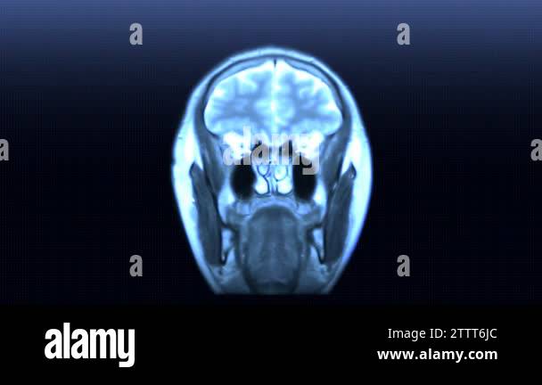 Mri scan Stock Videos & Footage - HD and 4K Video Clips - Alamy