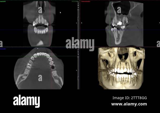 real life MRI scan of man jaws for stomatology dentist research new ...