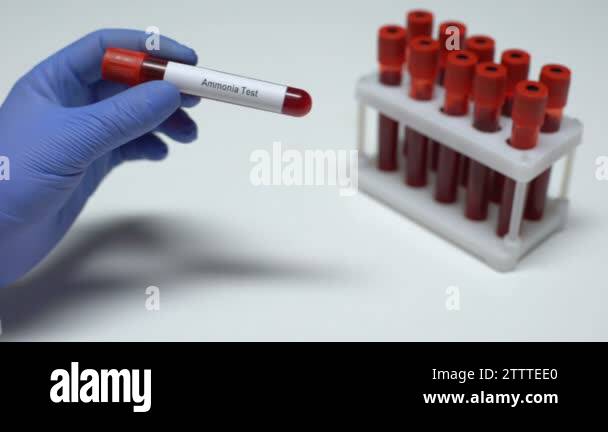 Ammonia test, doctor showing blood sample in tube, lab research, health ...