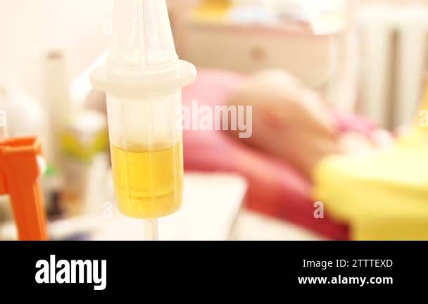 Plasma transfusion Stock Videos & Footage - HD and 4K Video Clips - Alamy