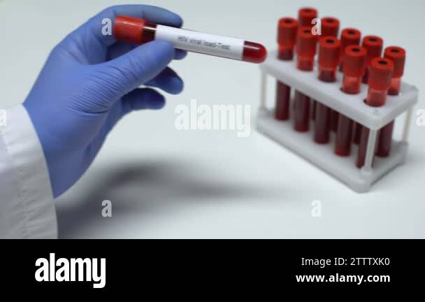 Viral load Stock Videos & Footage - HD and 4K Video Clips - Alamy